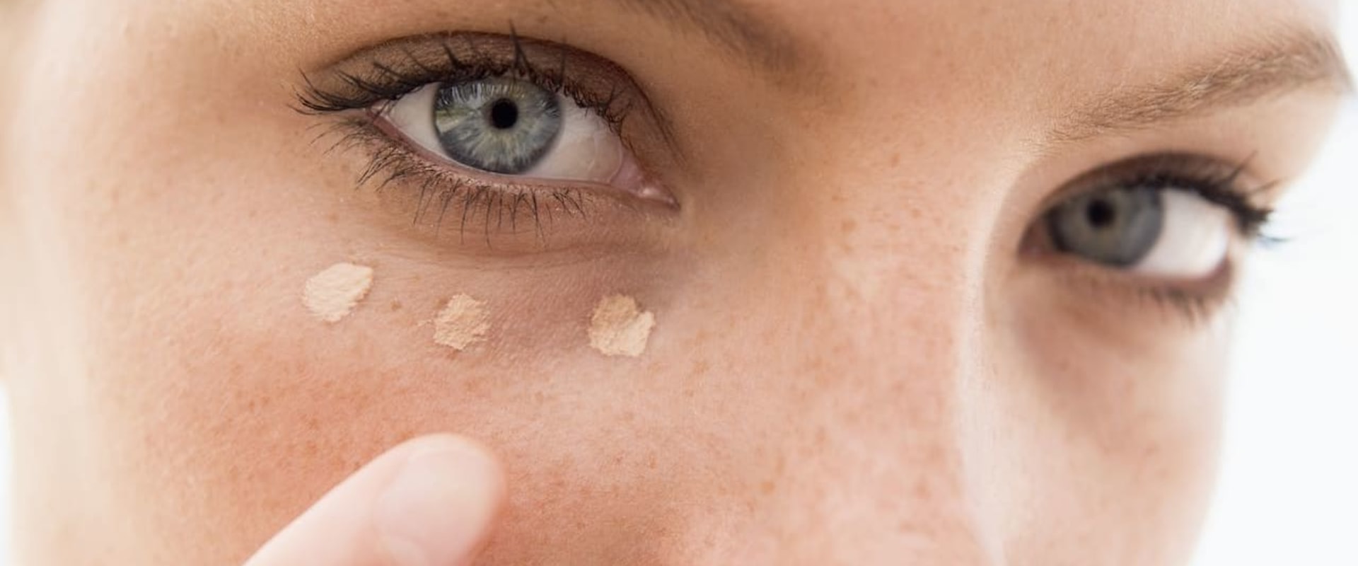 Managing Swelling and Bruising After Laser Skin Resurfacing Treatment